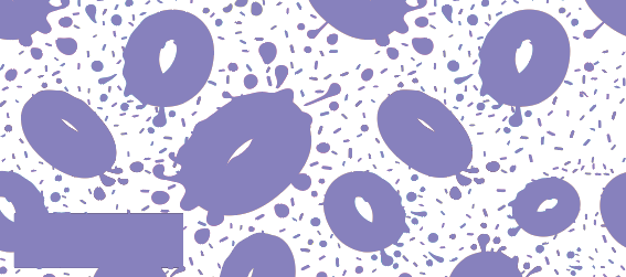 What is Spot Varnish in UV Printing? - Inkcups